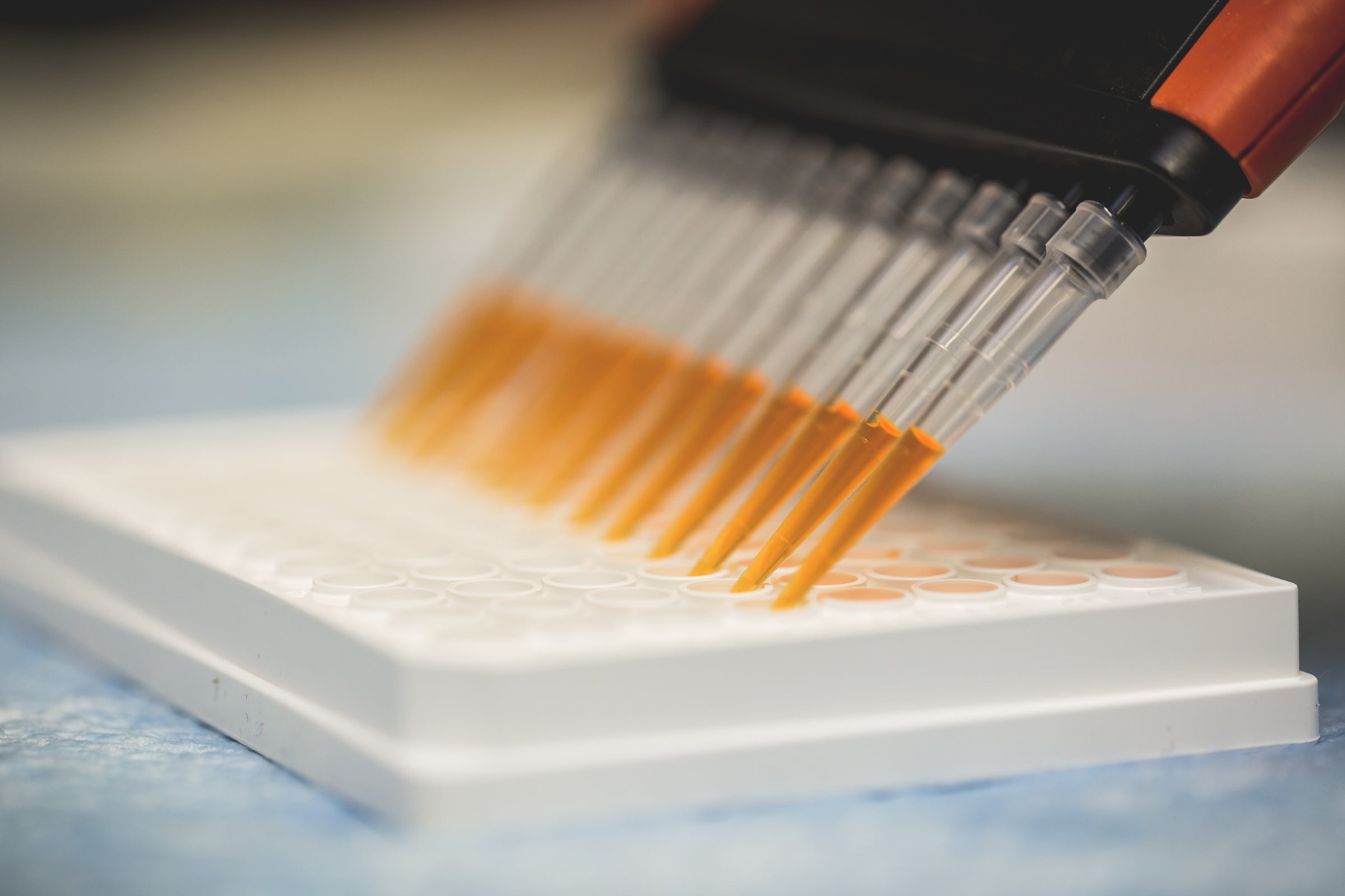 ELISA Kits | UK Immunodiagnostics Developer and Distributor – J R ...